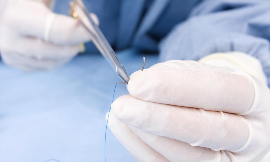 Po jakim czasie od zabiegu chirurgicznego usuwane są szwy?